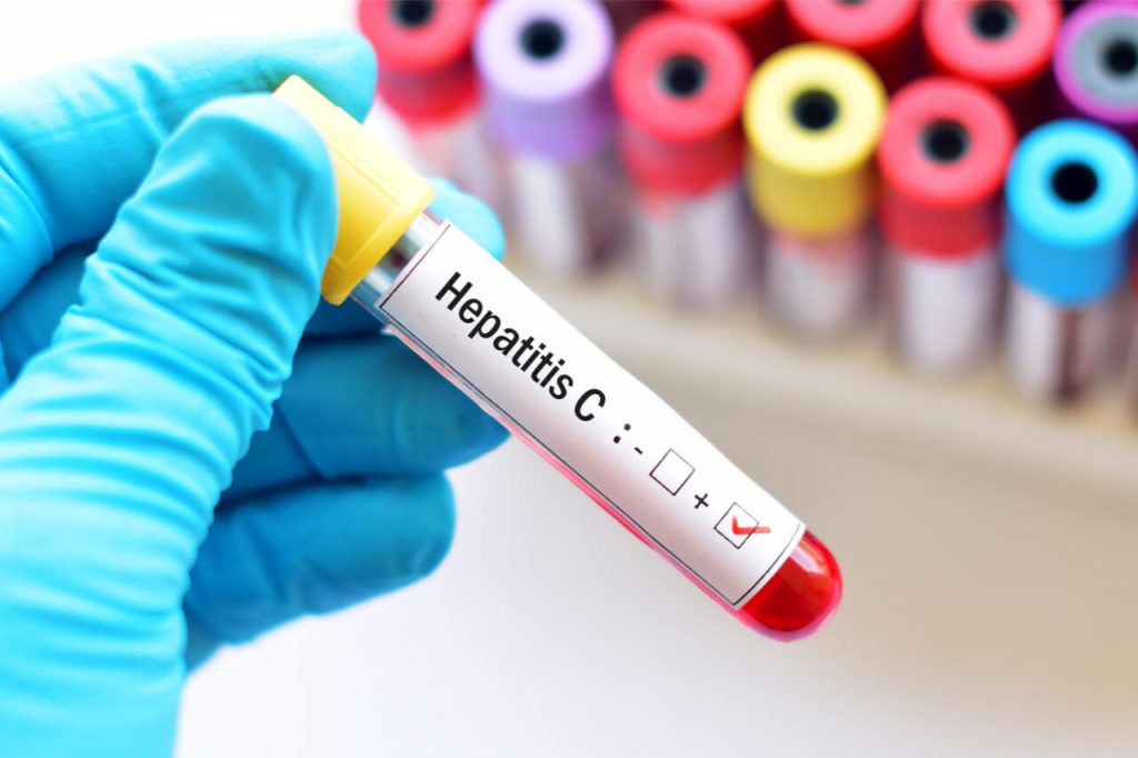 Is Hepatitis C Contagious Deciphering The Misconceptions 3689