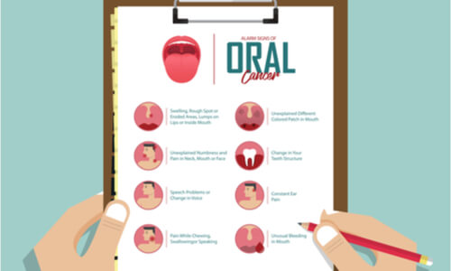 Oral Cancer Stages: Identification And Treatment Options